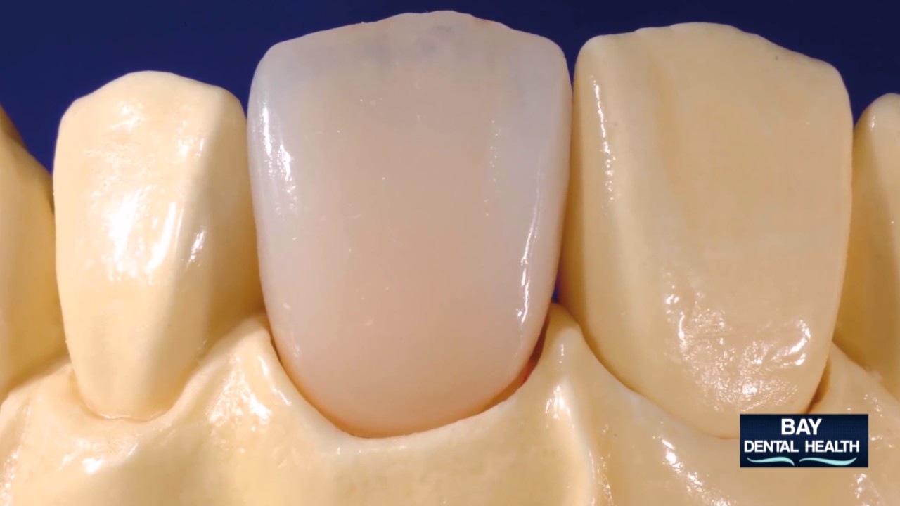 Dr. Eugene Antenucci | Fillings/Composite Resin