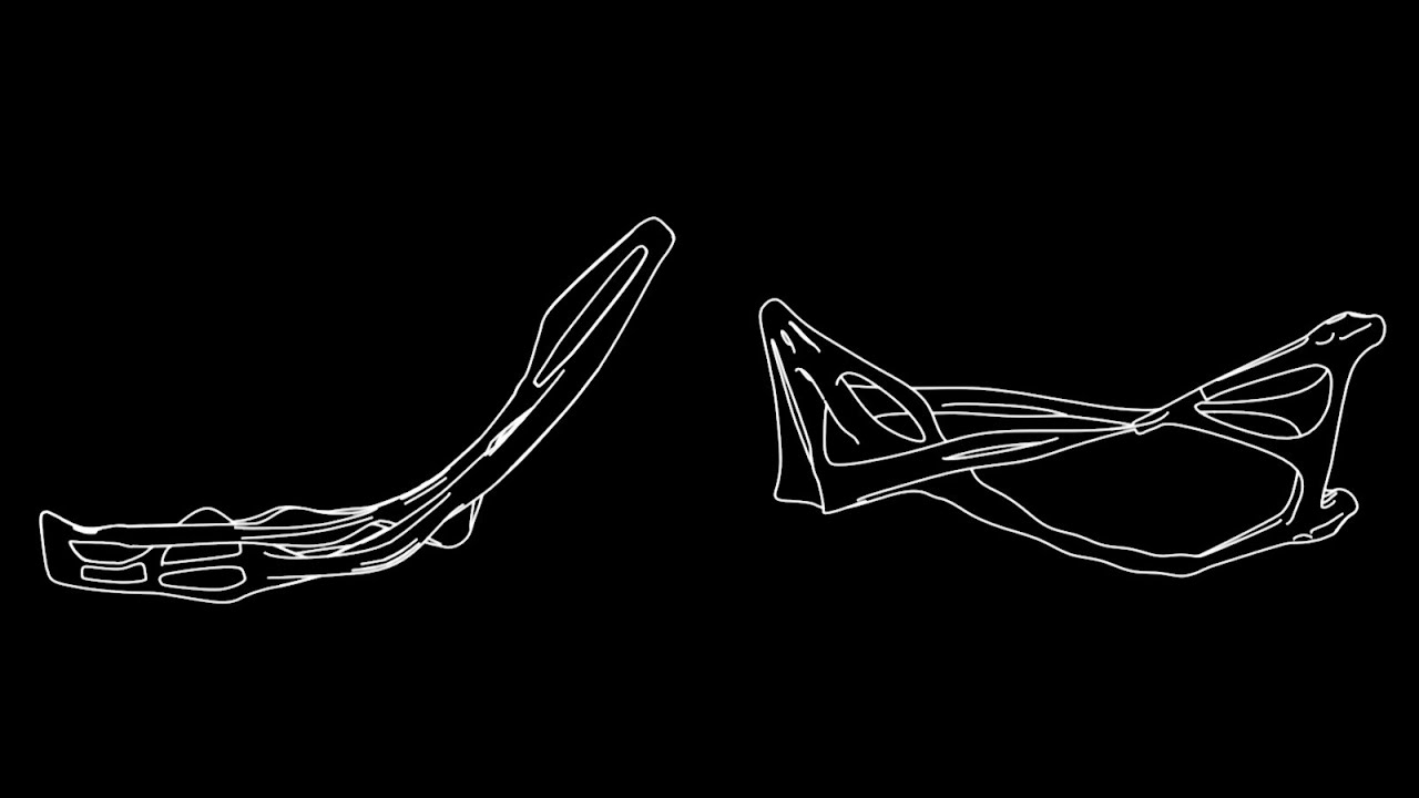 Arm Splint Design Showcase