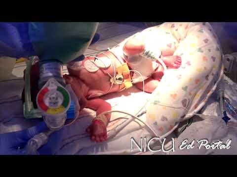 Beractant Intratracheal injection - Survanta Injection Latest Price ...