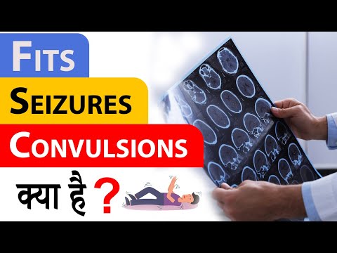 Fits, Seizures and Convulsions क्या है?