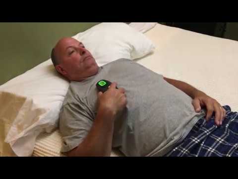 Implantable Device for Sleep Apnea | Section of Sleep Medicine ...