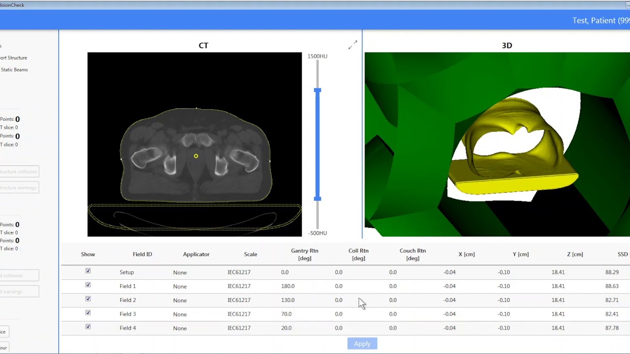Introducing ClearCheck
