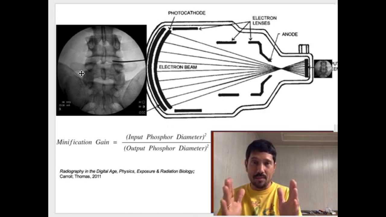XRayBob Minification, Flux, & Brightness Gain Math Examples