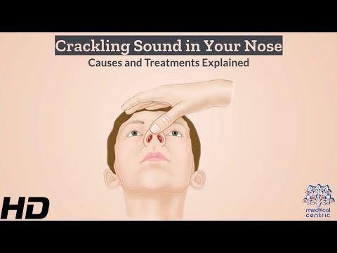 Crackling Noise in Your Nose? Discover the Triggers and Solution