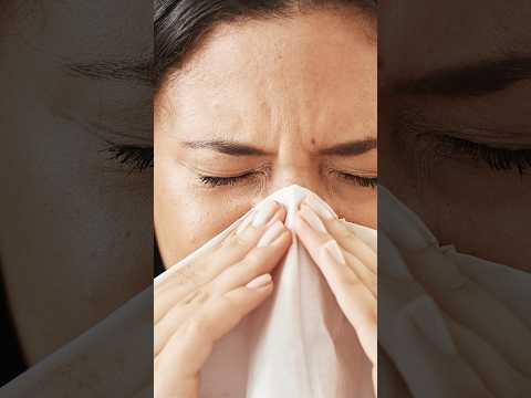 What is Chronic Sinusitis?