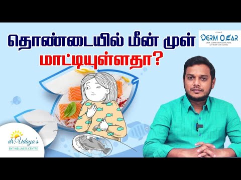 தொண்டையில் மீன் முள் மாட்டியுள்ளதா | Throat Problem in Tamil | Sore Throat  | Dr Udaya | Chennai