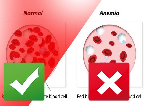 Anemia in Dogs - Causes, Symptoms and treatments