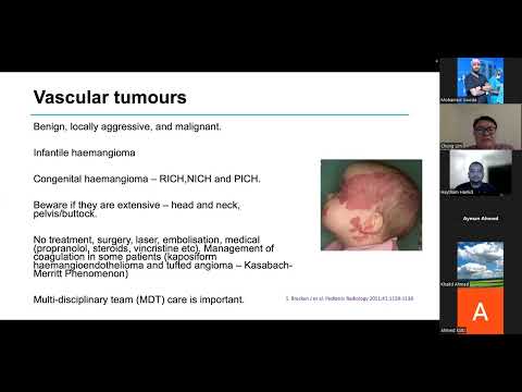 Mr. Chung Lim AV malformation session
