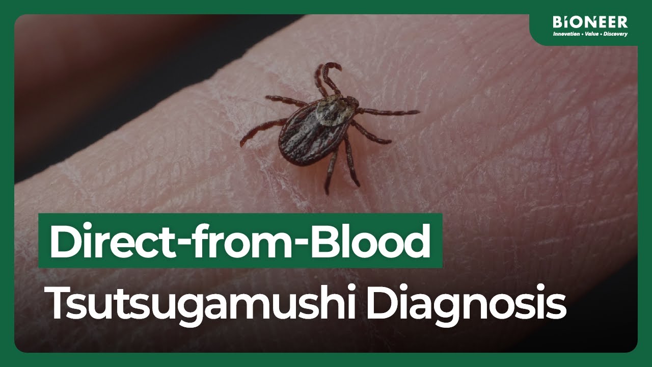 IRON-qPCR™ Tsutsugamushi Real Time PCR Kit, From blood sample to answer!