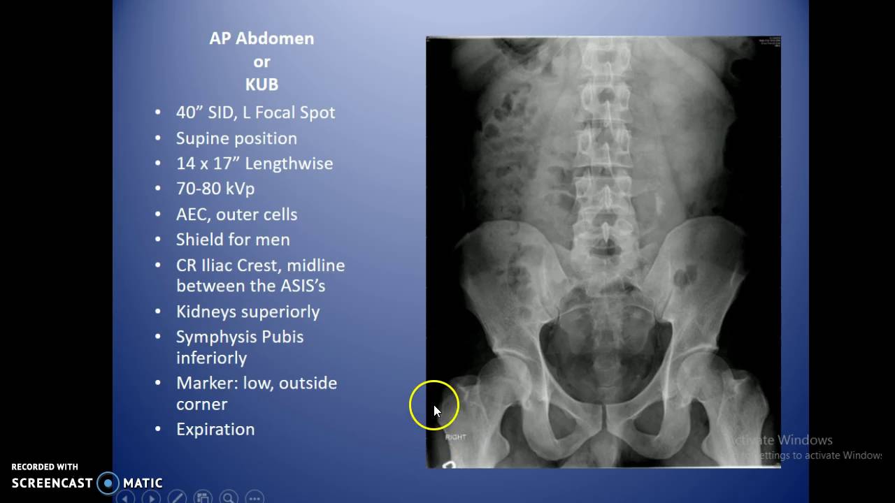 PPT Abdomen X-rays Voice-over