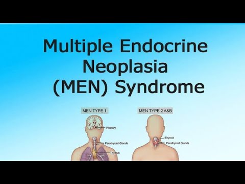 MEN Syndrome | First Aid | Made Easy