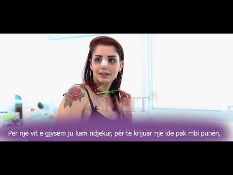 Agnese (rinoplastikë)