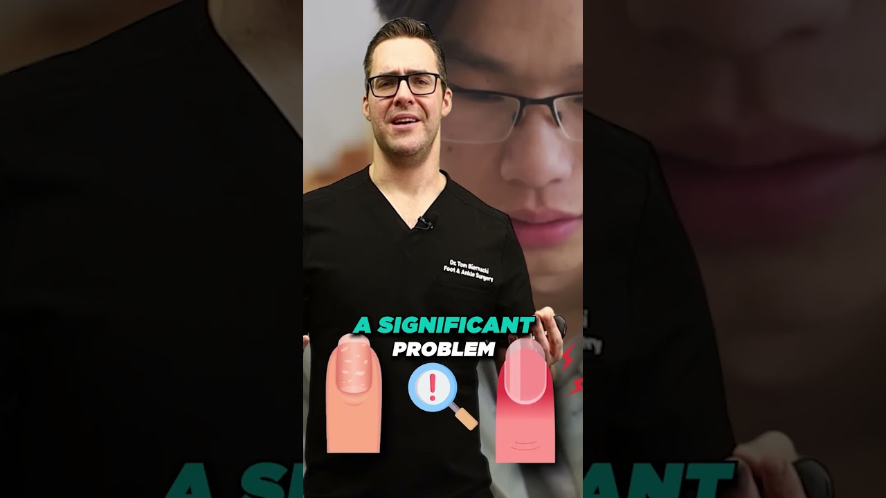What are Horizontal Lines on Fingernails & TOENAILS? [ Beau's Lines or Ridges: # 1 Cause? Health?]