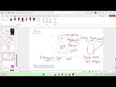 Lec 2.3 Biliary Hamartomas or Von Meyerberg Complexes || Liver || Ultrasound