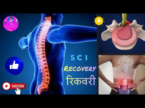 Story of SCI Complete Paralysis Patient, 13 Years Recovery after spinal cord injury' ✔️ #SUBSCRIBE 👍