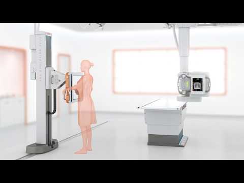 Carestream Digital Radiography X-Ray Systems - Carestream DRX-Evolution ...