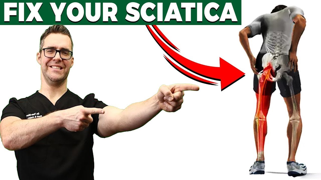 How To Cure Sciatica Permanently [Treatment, Stretches, Exercises]