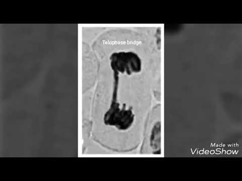Sticky bridge abnormality(Mitotic Anaphase-Telophase)