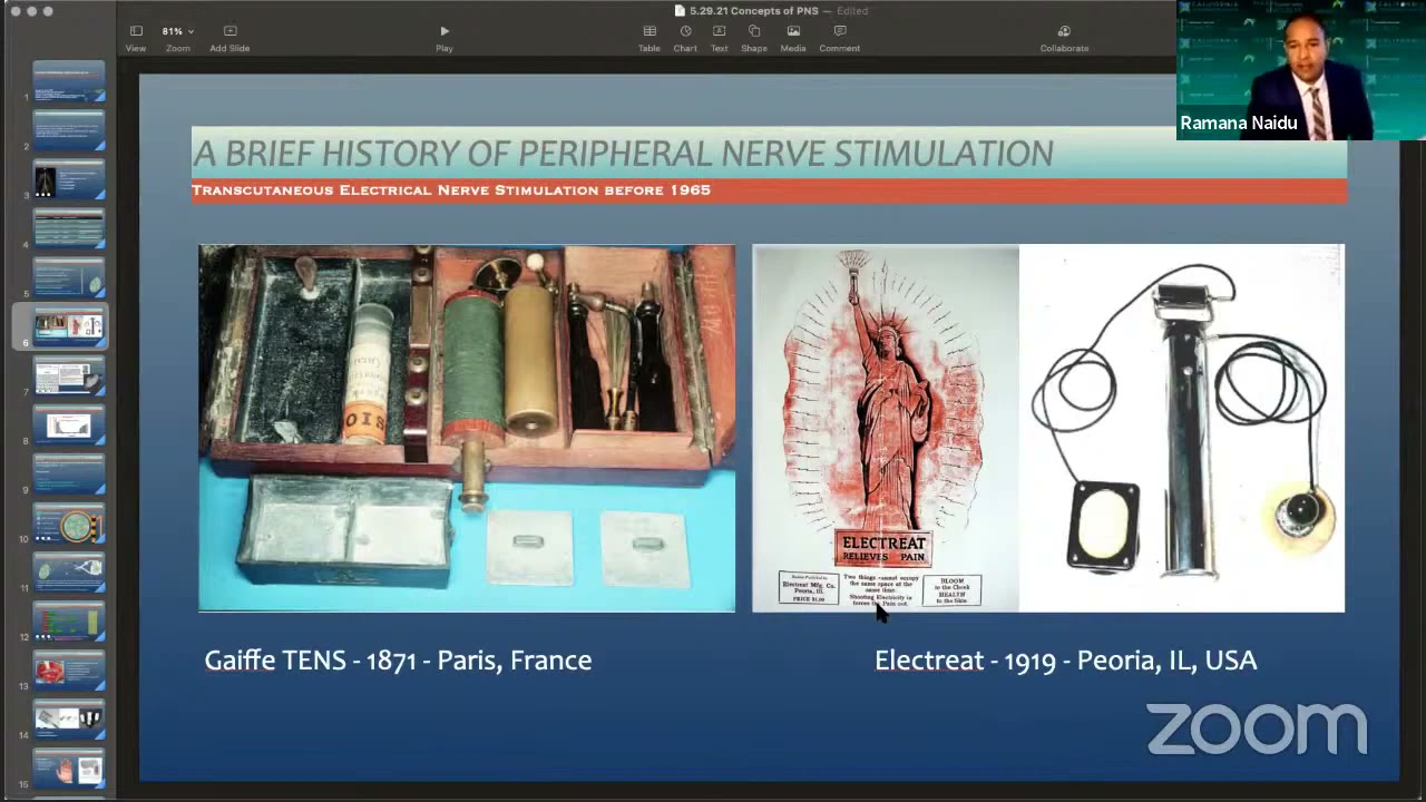Concepts of Peripheral Nerve Stimulation