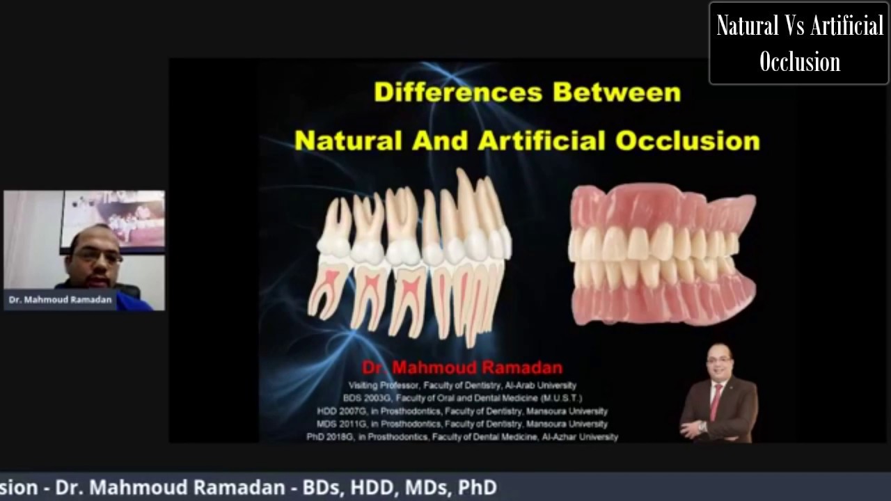 4- Differences between natural and artificial occlusion
