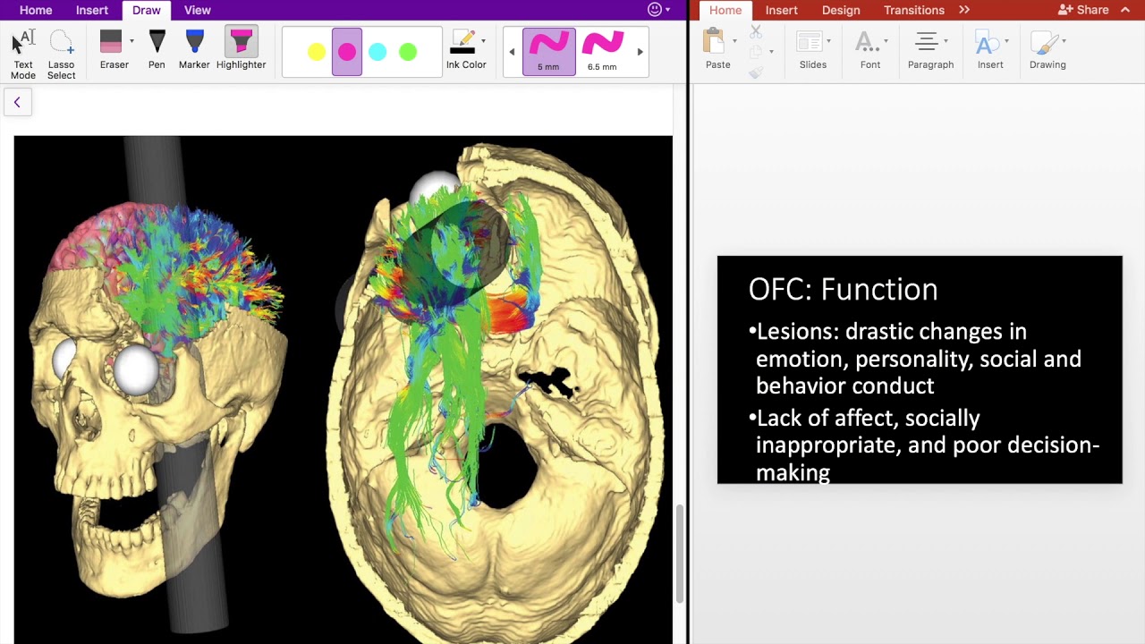 Frontal Lobe Circuits 3 (Orbitofrontal Cortex) OFC
