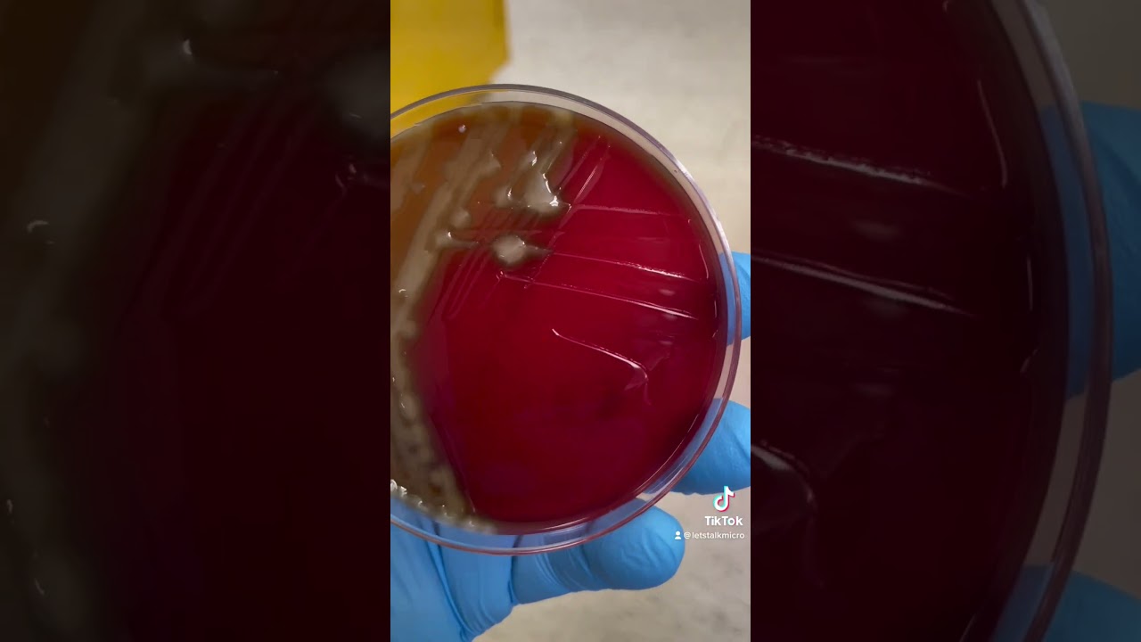 Streptococcus pneumoniae