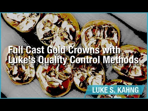 Full Cast Gold Crowns with Luke's Quality Control Methods