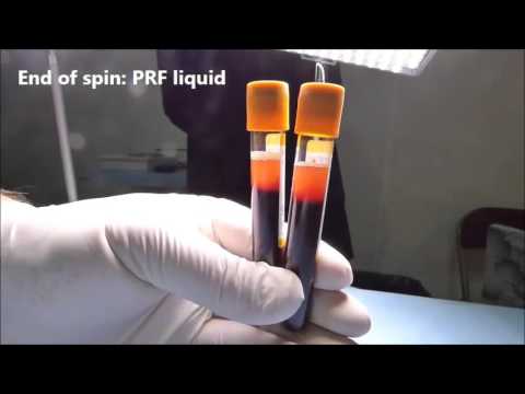 PRP Tubes - Plasma Rich Platelet Tube Latest Price, Manufacturers ...