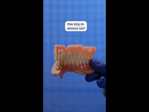 Dentures: How Long Do They REALLY Last?
