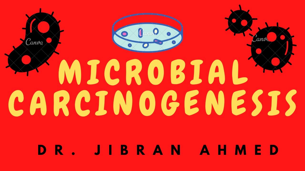 Understanding Microbial Carcinogenesis: Insights from Pathology | Galaxy.ai