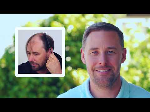 Advanced Hair Restoration Amazing Results - Best FUE Hair Transplant Clinic