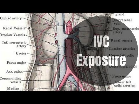 How To Expose Inferior Vena Cava ?