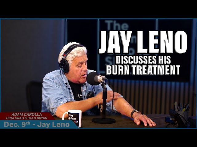 Jay Leno's new face: Comedian reflects on severe burn injuries on The Kelly Clarkson Show