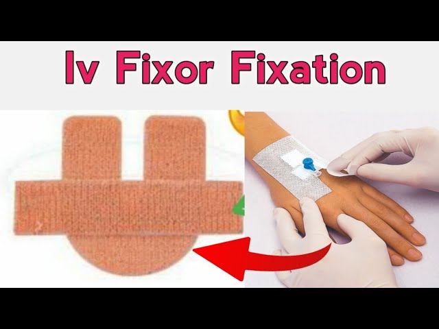 Cannula Fixator - IV Fixor Elastic Adhesive Bandage BP Cannula Fixator ...