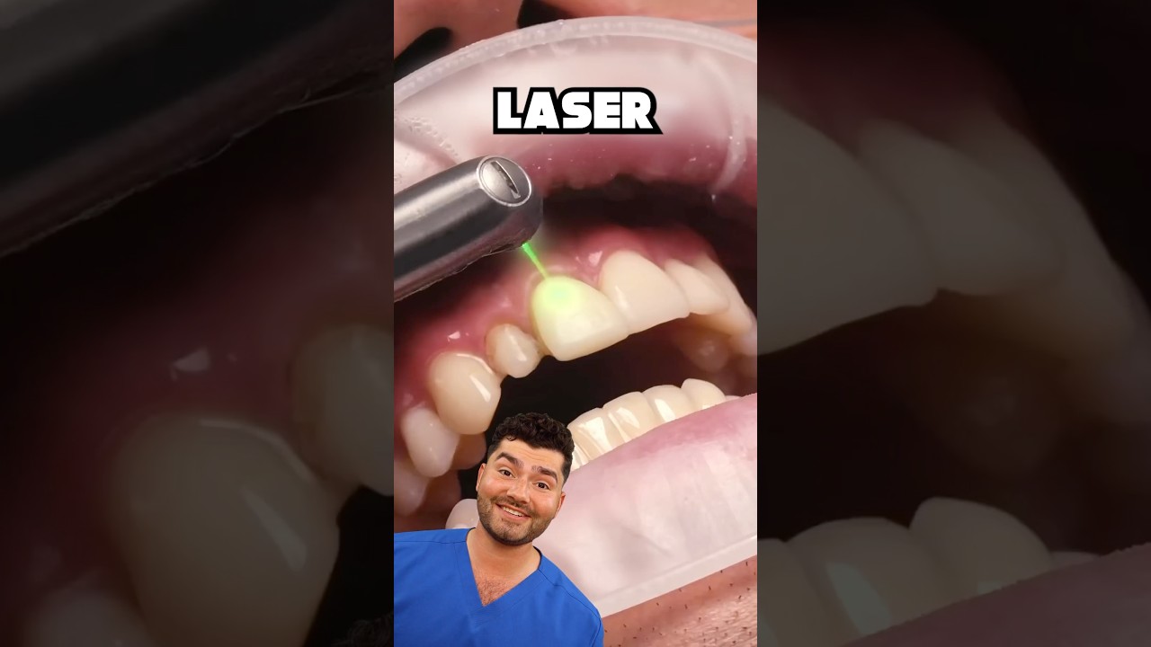 Dental Laser Explained !?