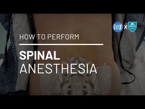 How to Perform Spinal Anesthesia