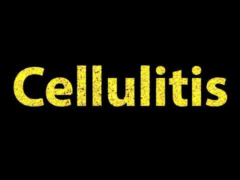 How To Pronounce Cellulitis