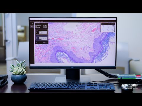 What is Digital Pathology for Dermatologists All About?