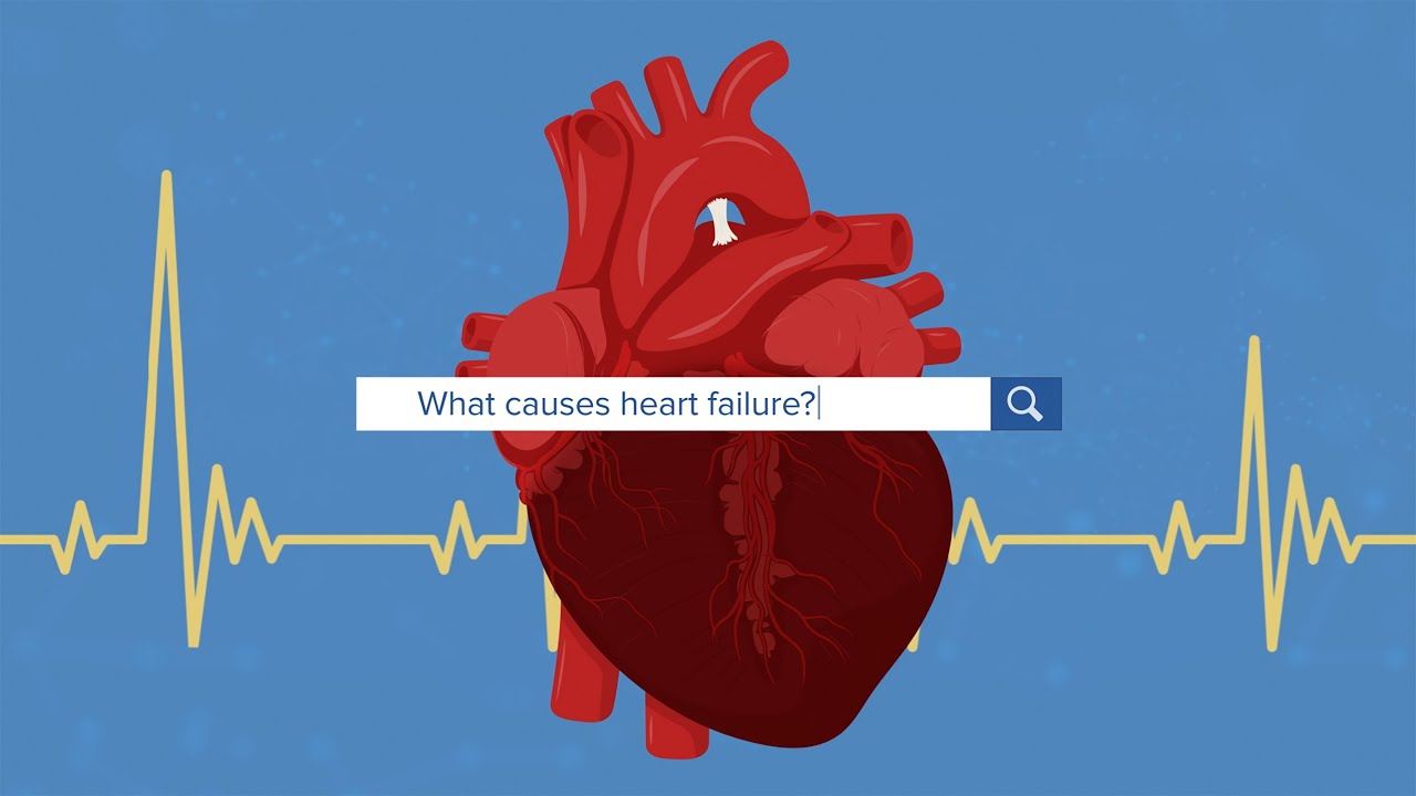 What Causes Heart Failure?