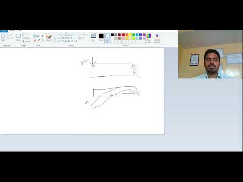 What is mean by DOF in FEA