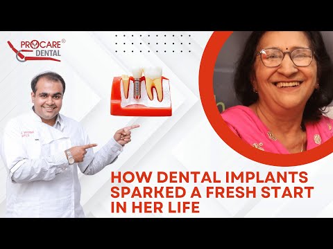 Dental Implant Story of Mridula Daiya's - Best Prosthodontist Treatment