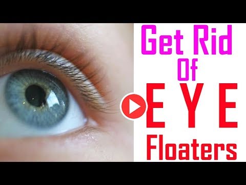 How To Get Rid Of Eye Floaters And Flashes – Remedies One – Site Title