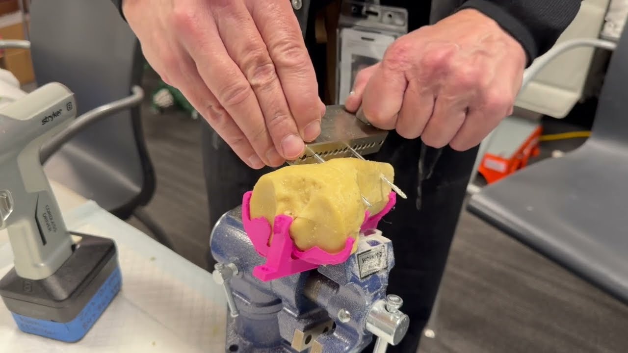 Fulkerson Osteotomy for Patella subluxation