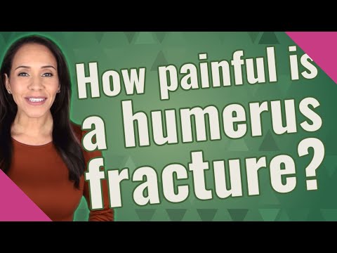 How painful is a humerus fracture?