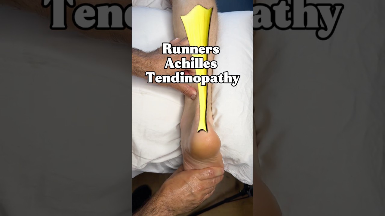 POV: Runners Achilles Tendinitis / Tendinopathy | MG Osteopathy