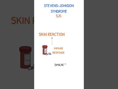 WHAT IS STEVENS JOHNSON SYNDROME