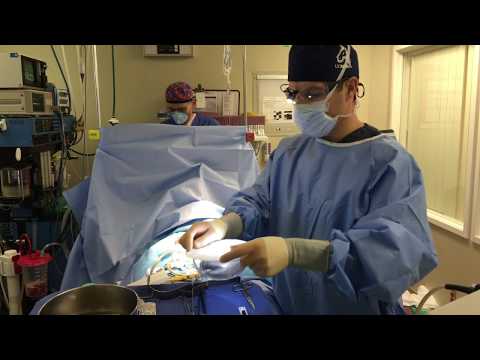 Illuminate Plastic Surgery: Breast Augmentation - No Touch Technique