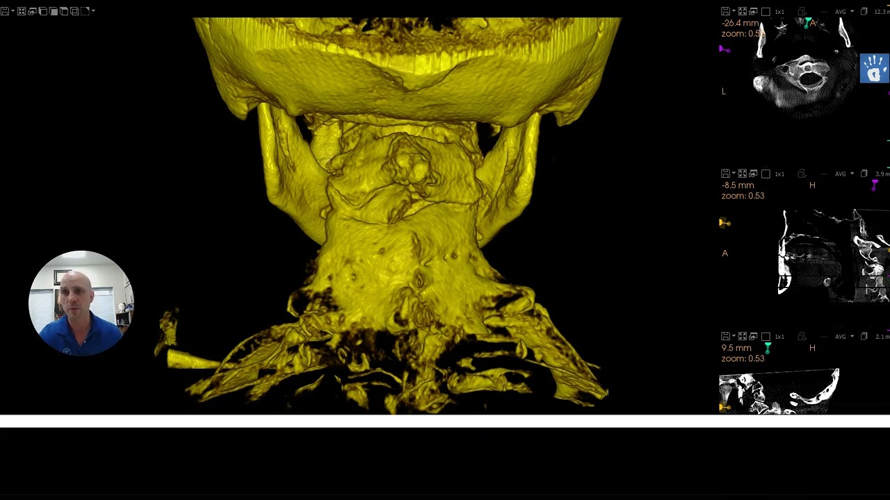 This Is Why 3D Imaging Is So Important