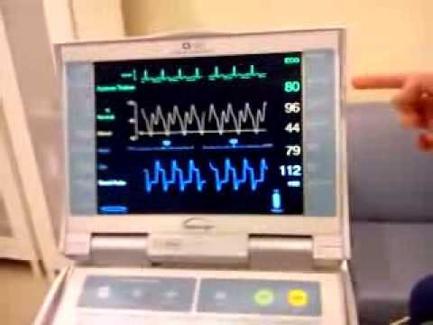 Intra Aortic Balloon Pump Machine - IABP Machine Latest Price ...