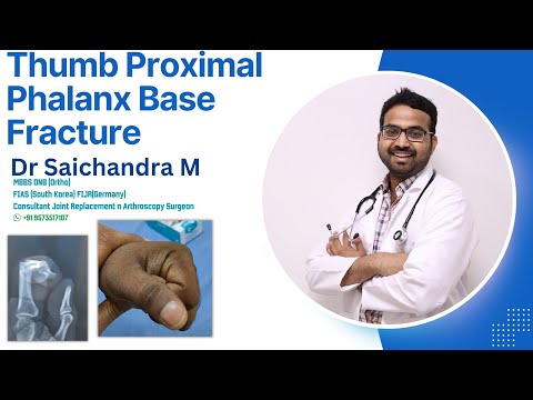 Thumb Proximal Phalanx Base Fracture..Dr Sai Chandra MBBS DNB Ortho